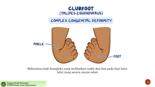 FISIOTERAPI PEDIATRI PADA KASUS - CTEV.pptx