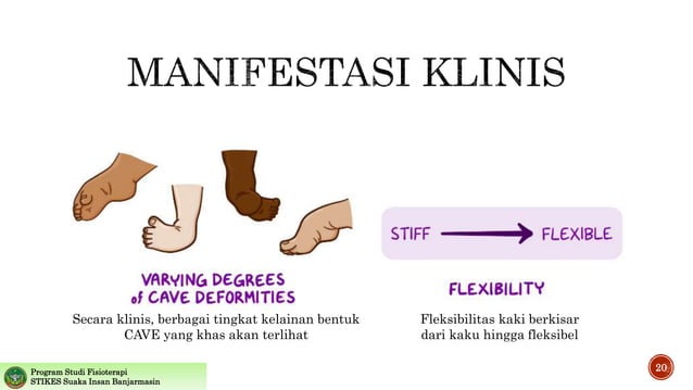 FISIOTERAPI PEDIATRI PADA KASUS - CTEV.pptx
