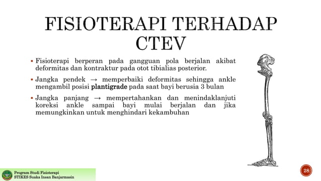 FISIOTERAPI PEDIATRI PADA KASUS - CTEV.pptx