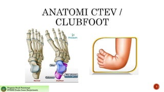 FISIOTERAPI PEDIATRI PADA KASUS - CTEV.pptx