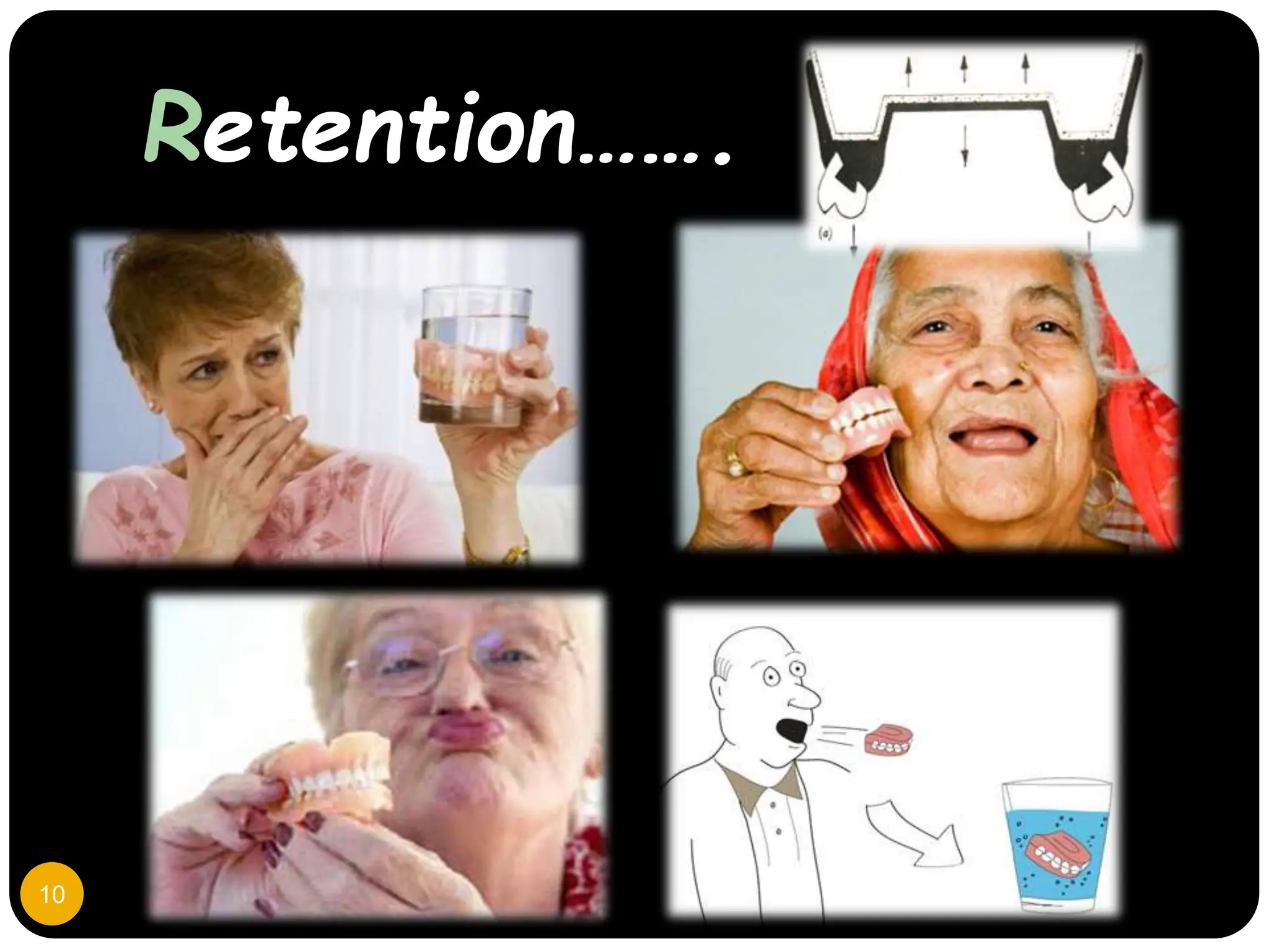 6.Retention, stability and support in complete denture.pptx