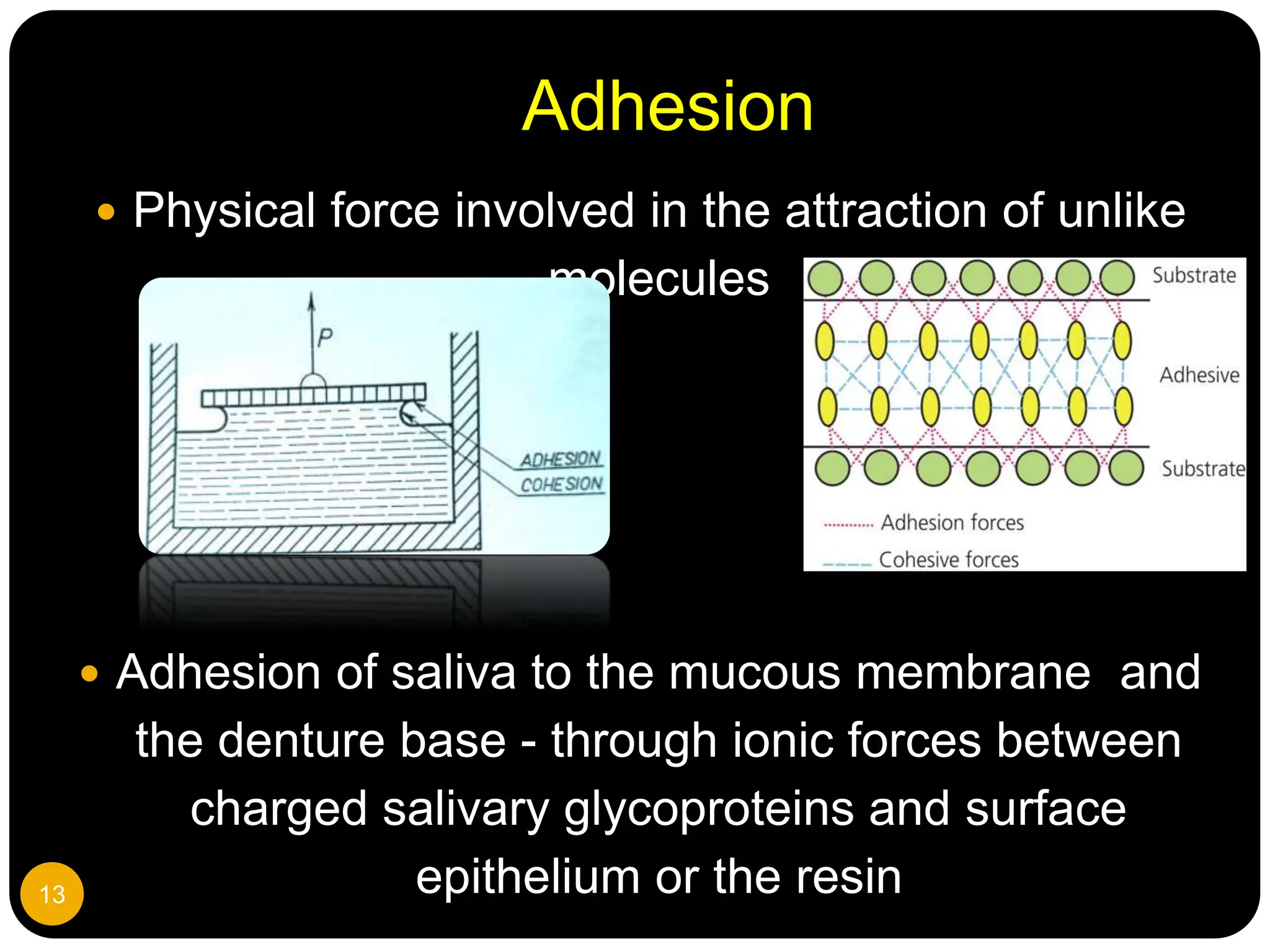 6.Retention, stability and support in complete denture.pptx