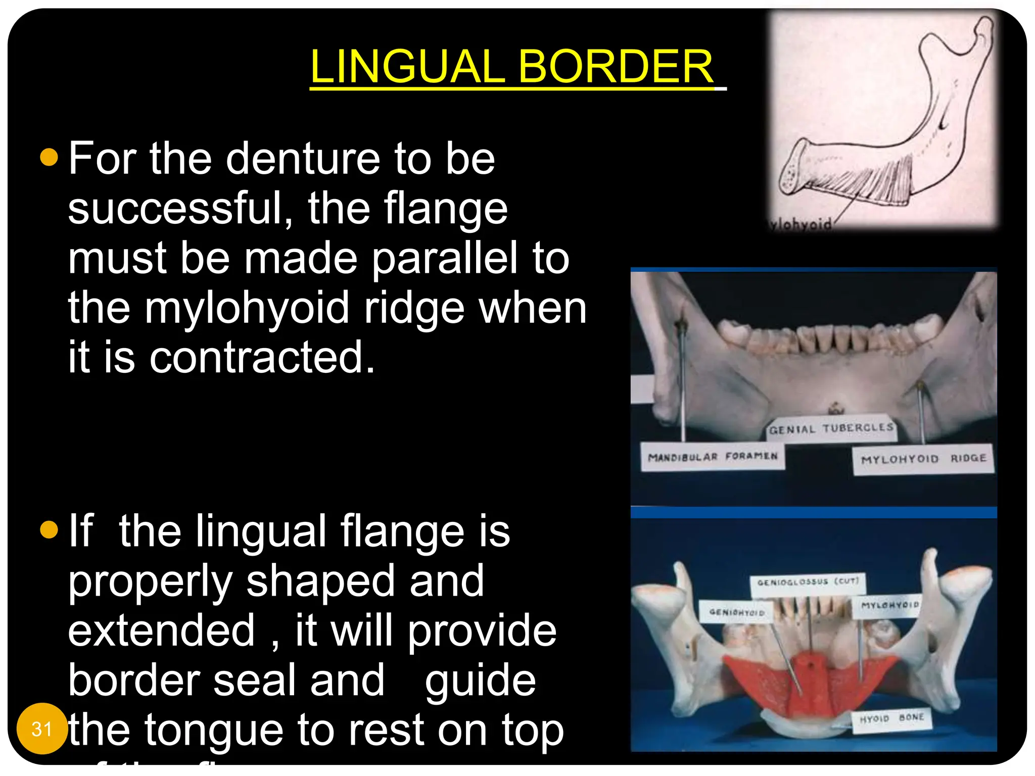 6.Retention, stability and support in complete denture.pptx