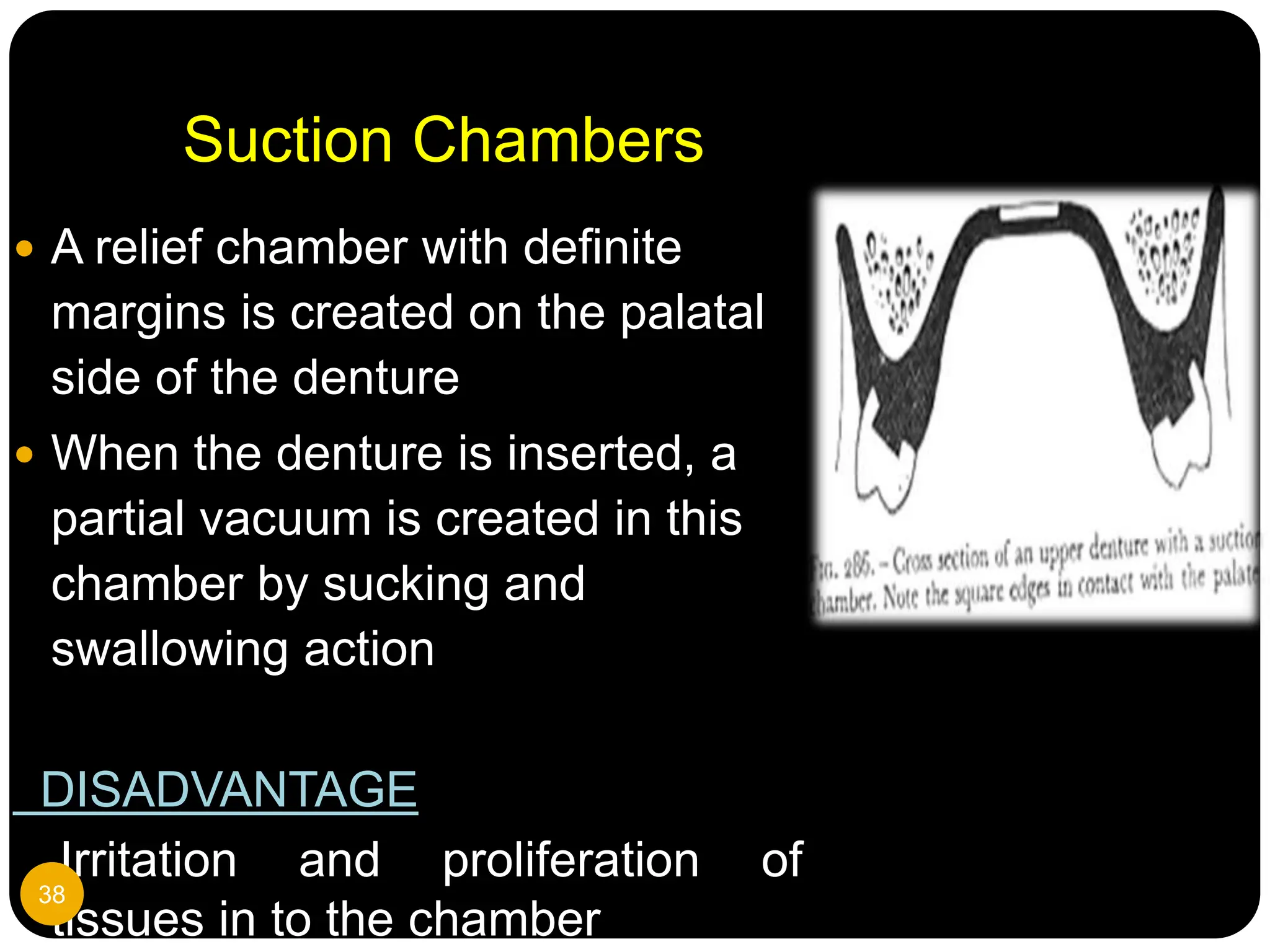 6.Retention, stability and support in complete denture.pptx