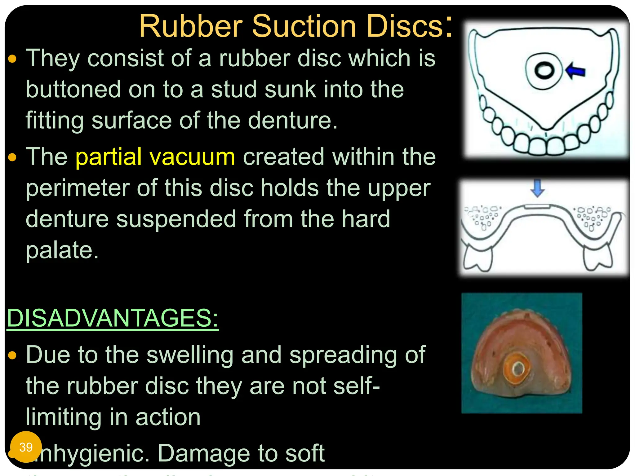 6.Retention, stability and support in complete denture.pptx