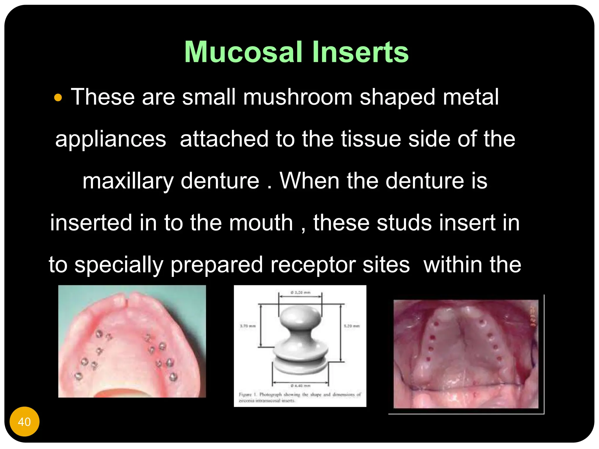 6.Retention, stability and support in complete denture.pptx