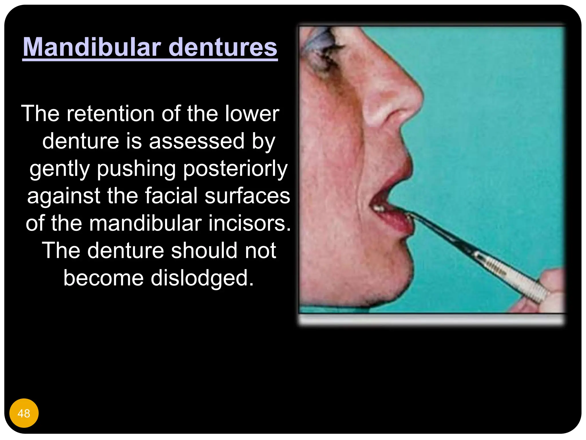 6.Retention, stability and support in complete denture.pptx