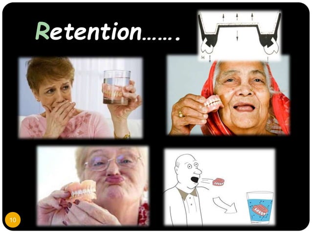 6.Retention, stability and support in complete denture.pptx | Oral care ...