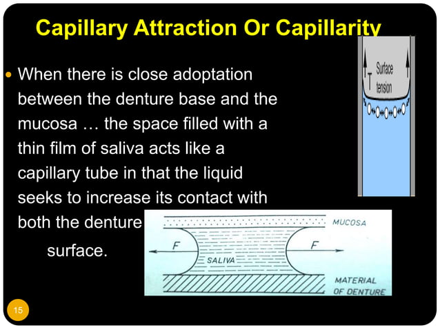 6.Retention, stability and support in complete denture.pptx | Oral care ...