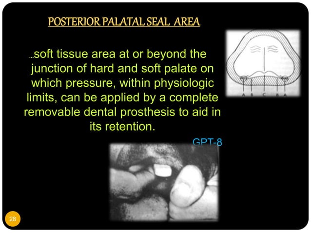 6.Retention, stability and support in complete denture.pptx | Oral care ...
