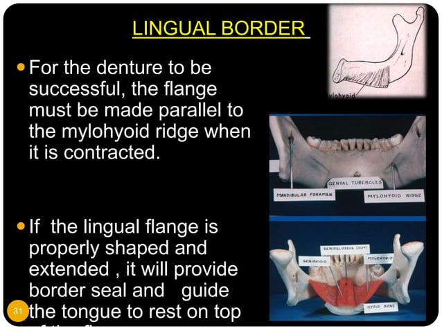 6.Retention, stability and support in complete denture.pptx | Oral care ...