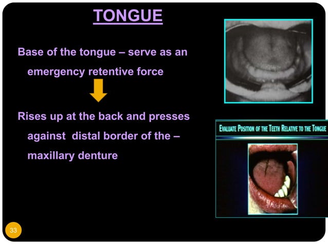 6.Retention, stability and support in complete denture.pptx | Oral care ...