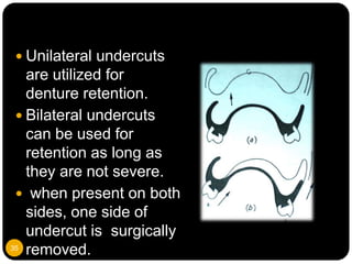 6.Retention, stability and support in complete denture.pptx