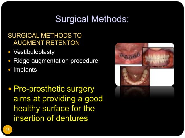 6.Retention, stability and support in complete denture.pptx | Oral care ...