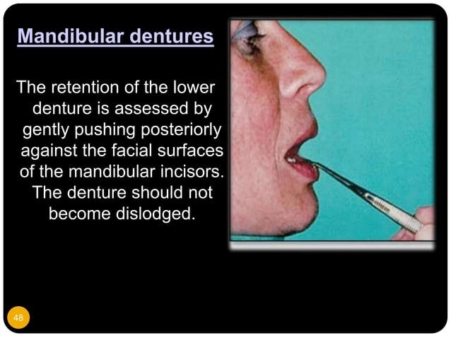 6.Retention, stability and support in complete denture.pptx | Oral care ...