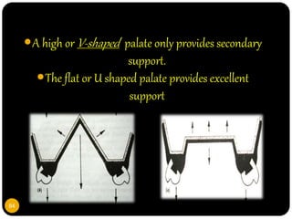 6.Retention, stability and support in complete denture.pptx