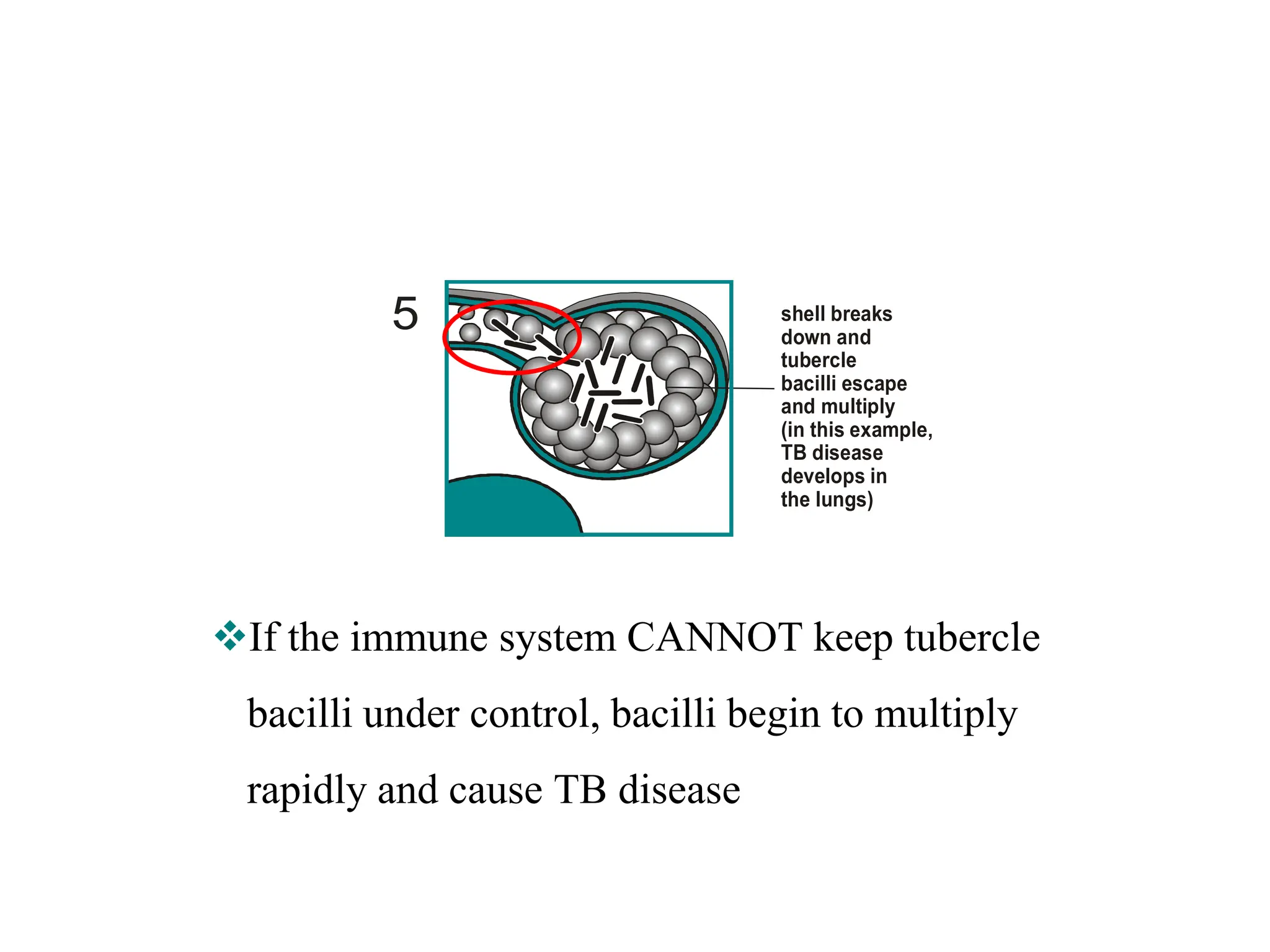 6.TUBERCLOSIS in respiratory part of study..pptx