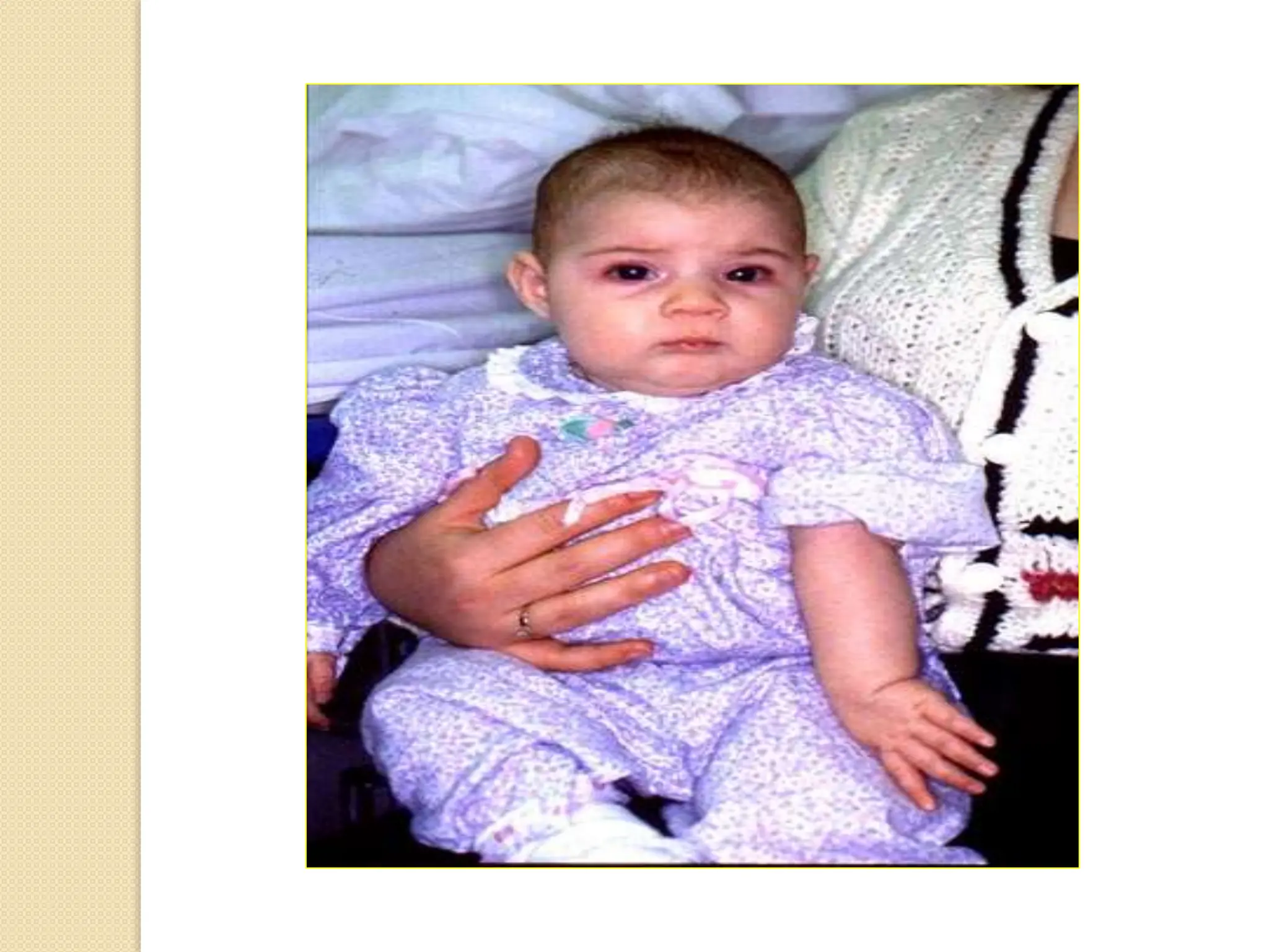 Birth Injury during delivery or high risk infants.pptx