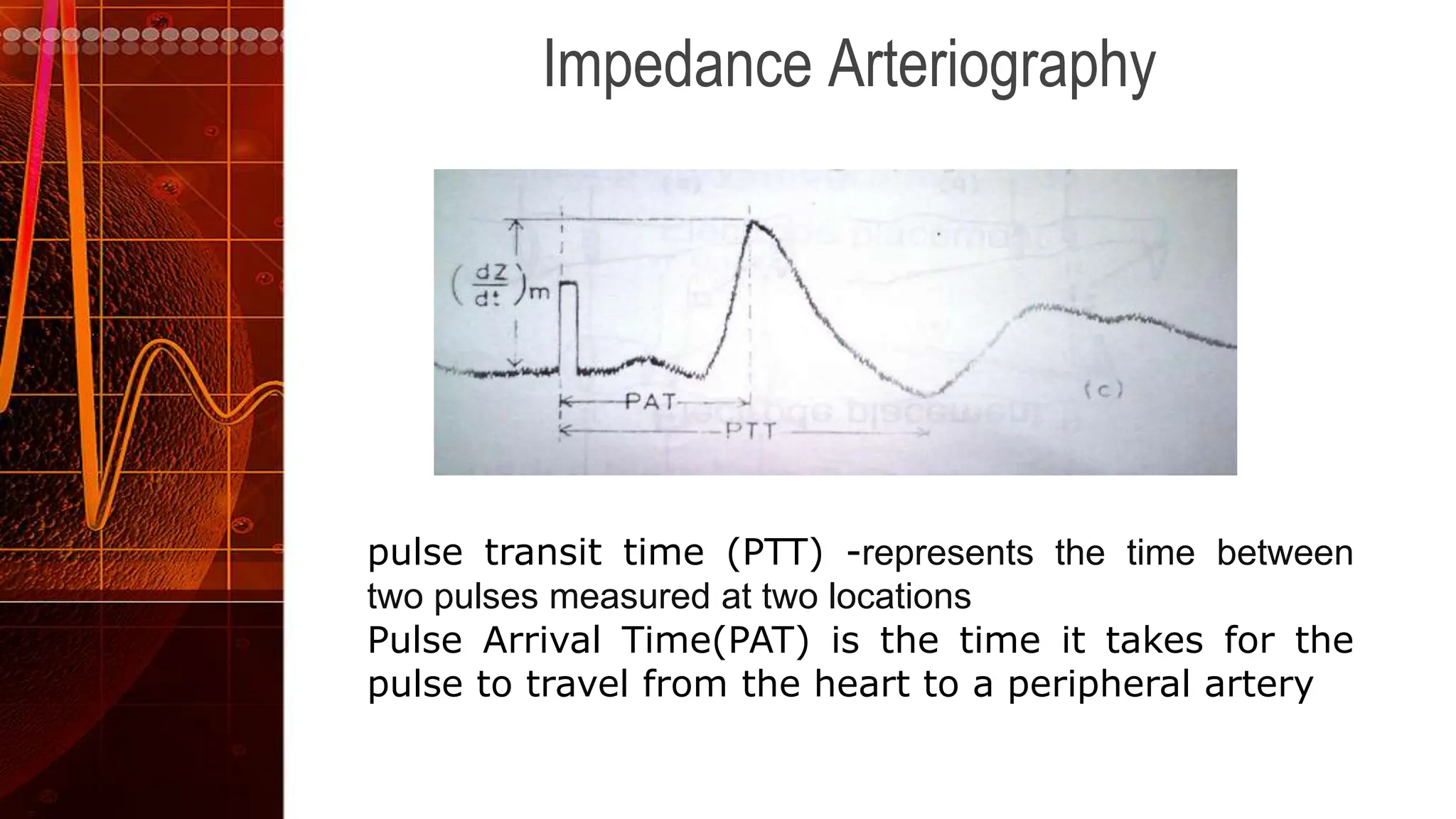 Impedance plethysmography Technique.pptx