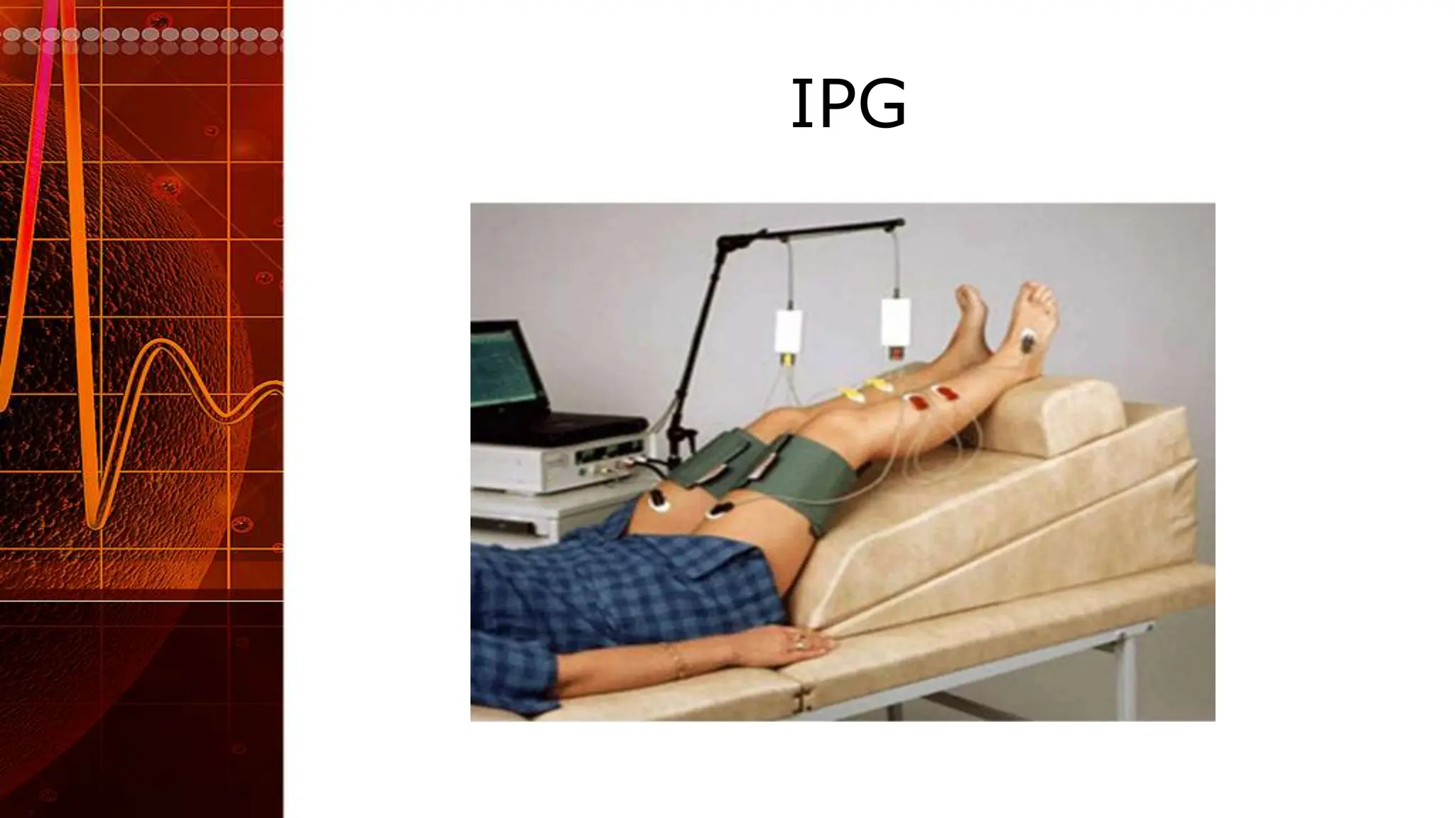 Impedance plethysmography Technique.pptx