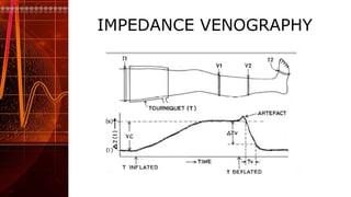 Impedance plethysmography Technique.pptx