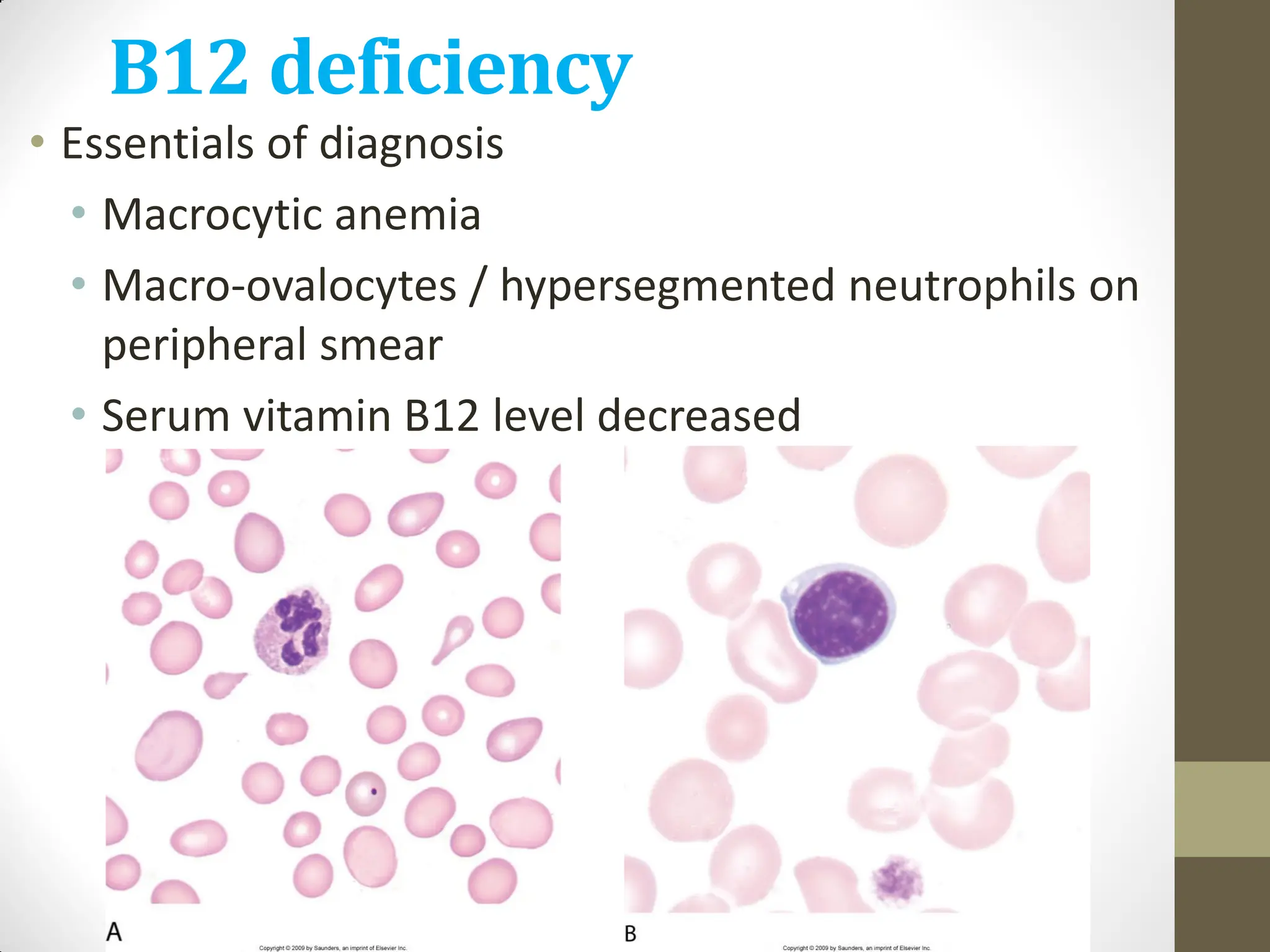 Anemia; causes, types, laboratory investigations | PDF