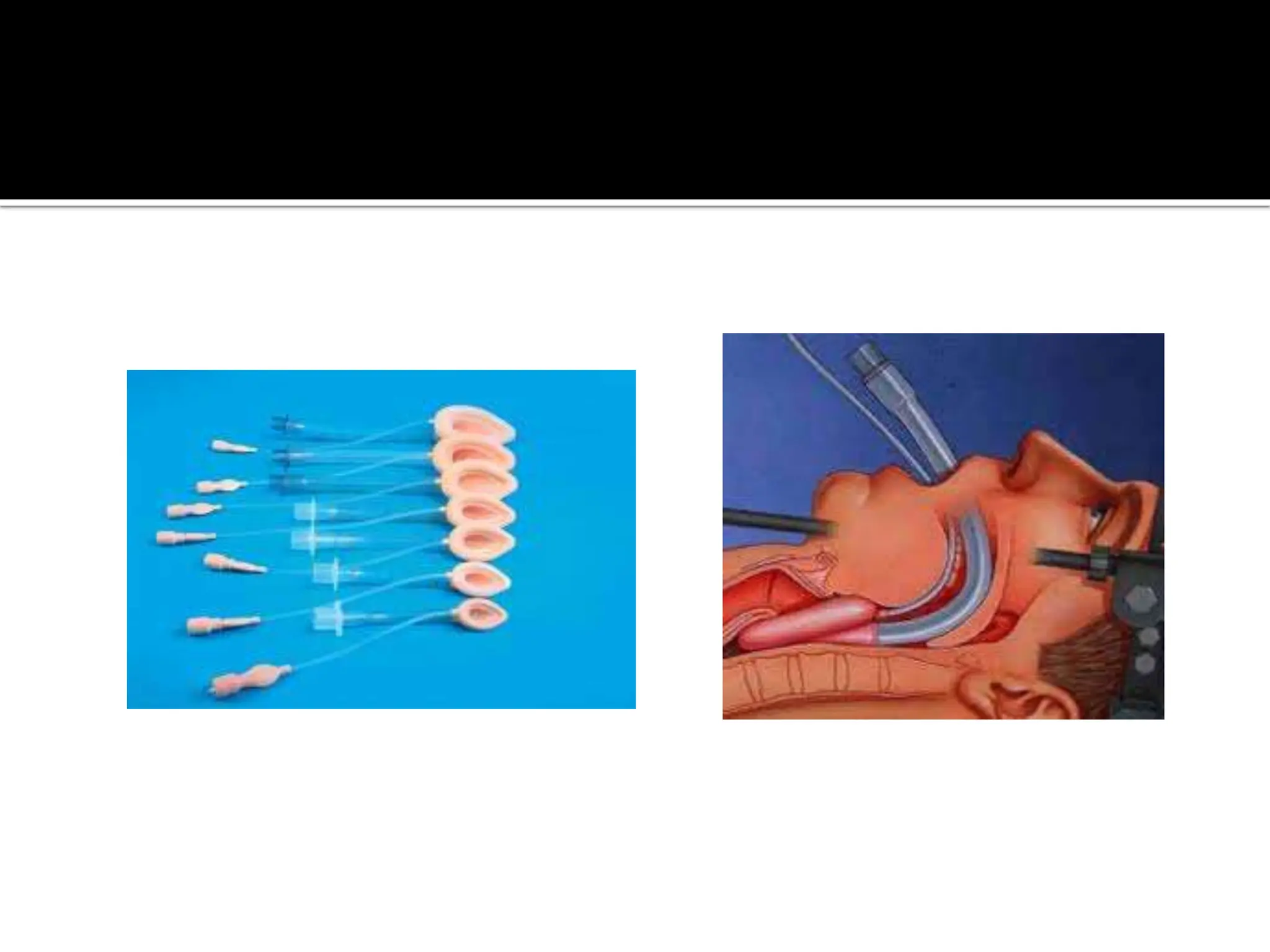 Neonatal resuscitation TABC ..........pptx