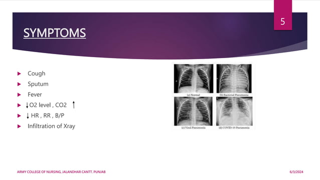 6. PREVENTION OF VAP and its treatment .pptx | Lung and Respiratory ...