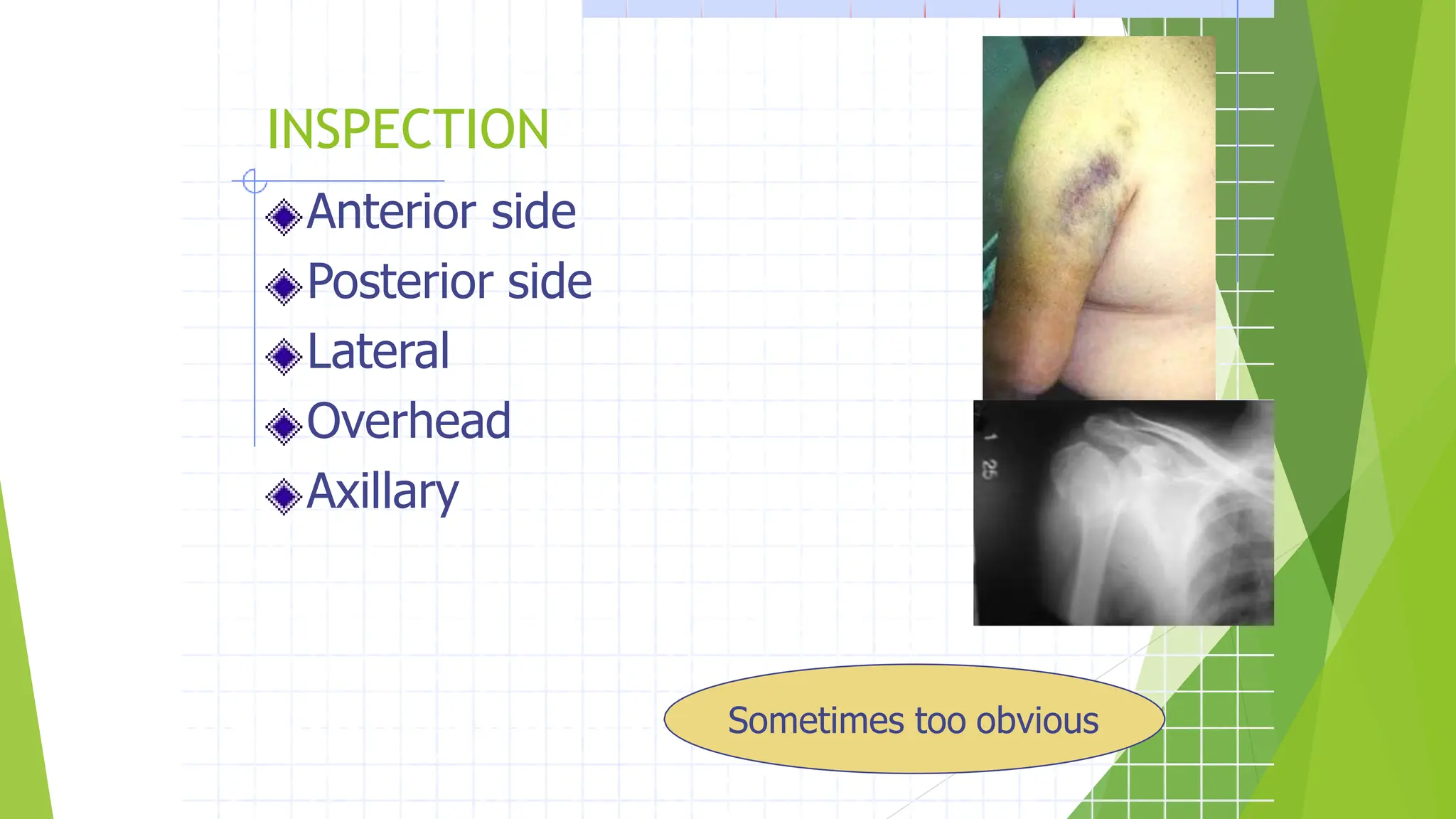 Shoulder Examinations and assessment PPT | PPTX