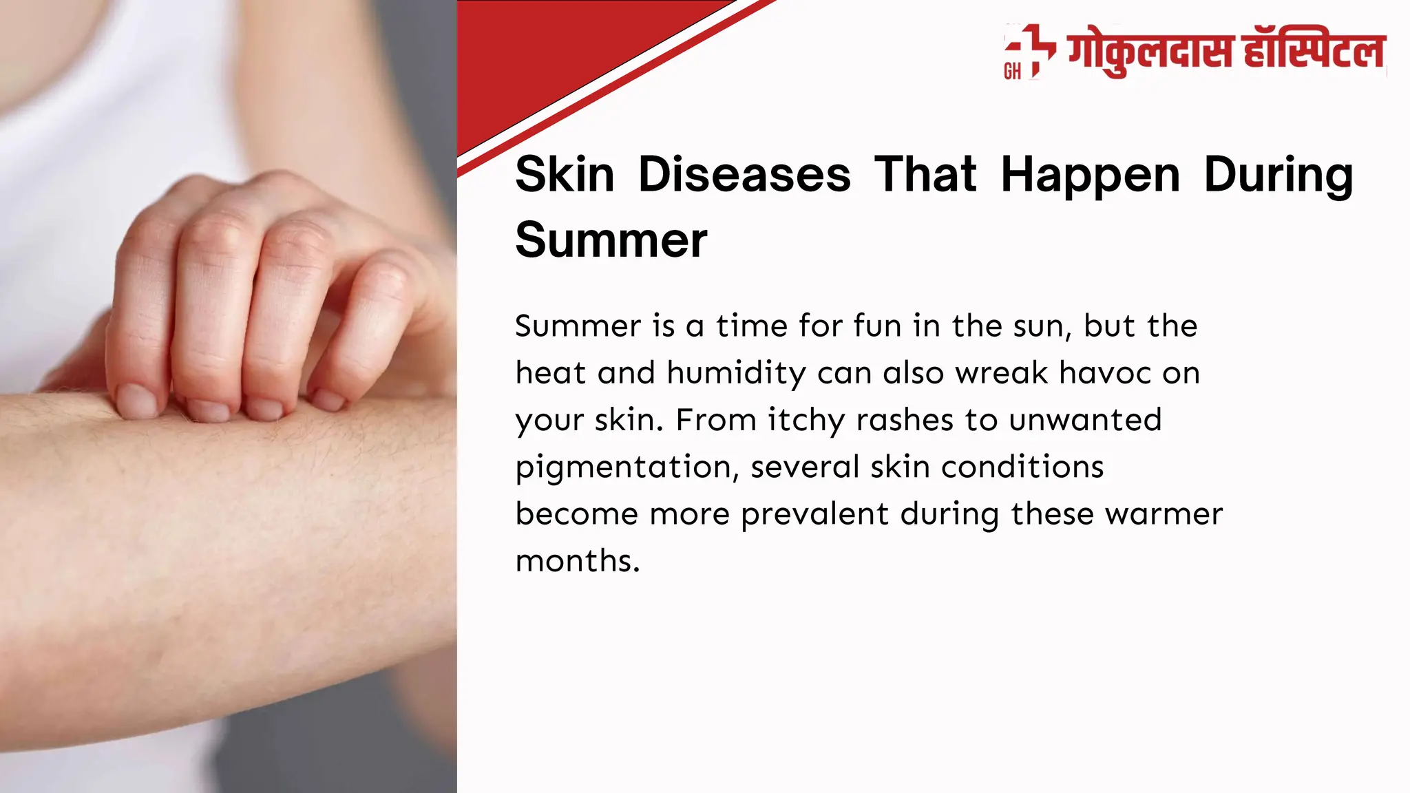 Skin Diseases That Happen During Summer. | PPTX