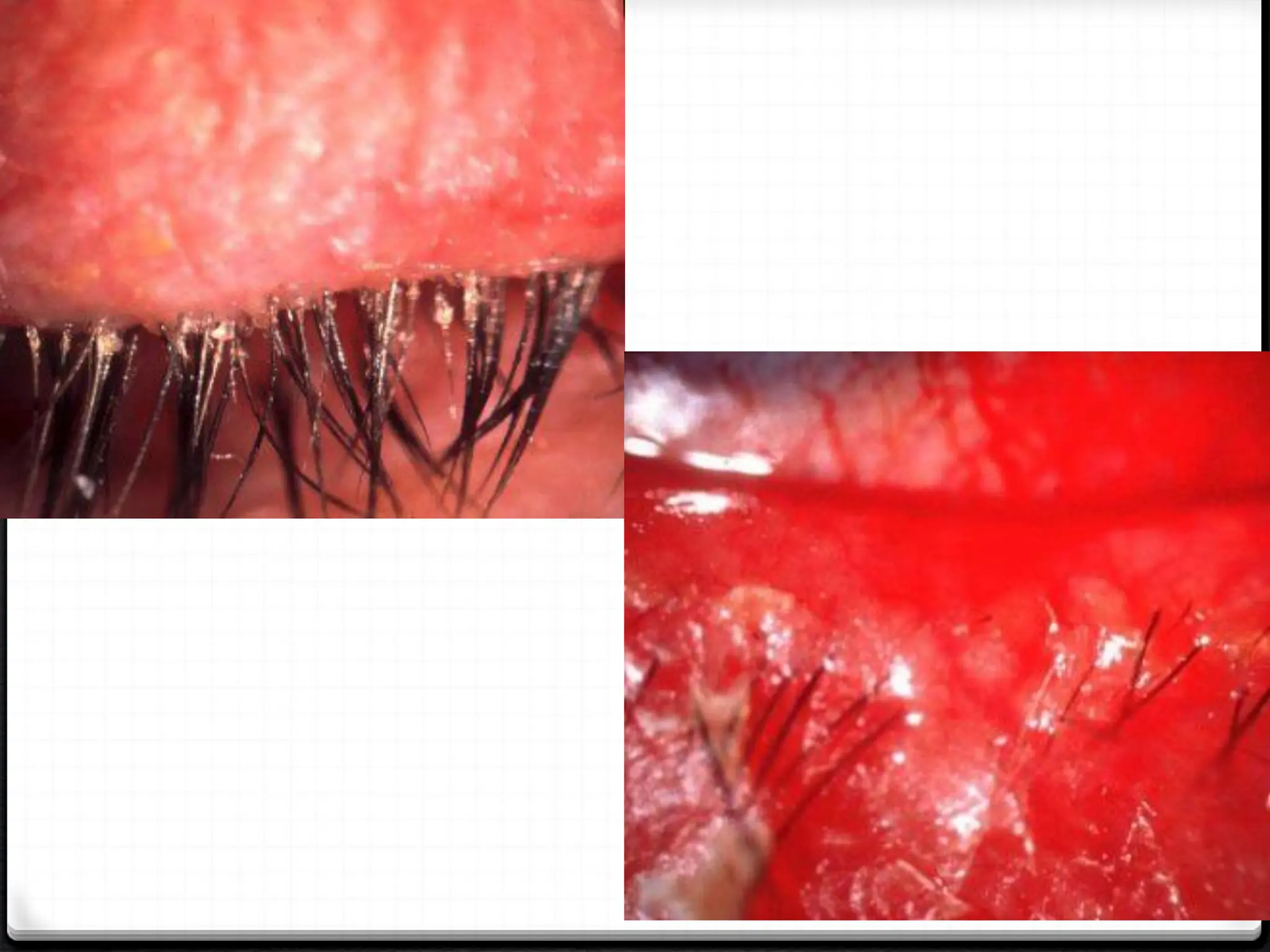 Red eye with Differentials and sample causes | PDF