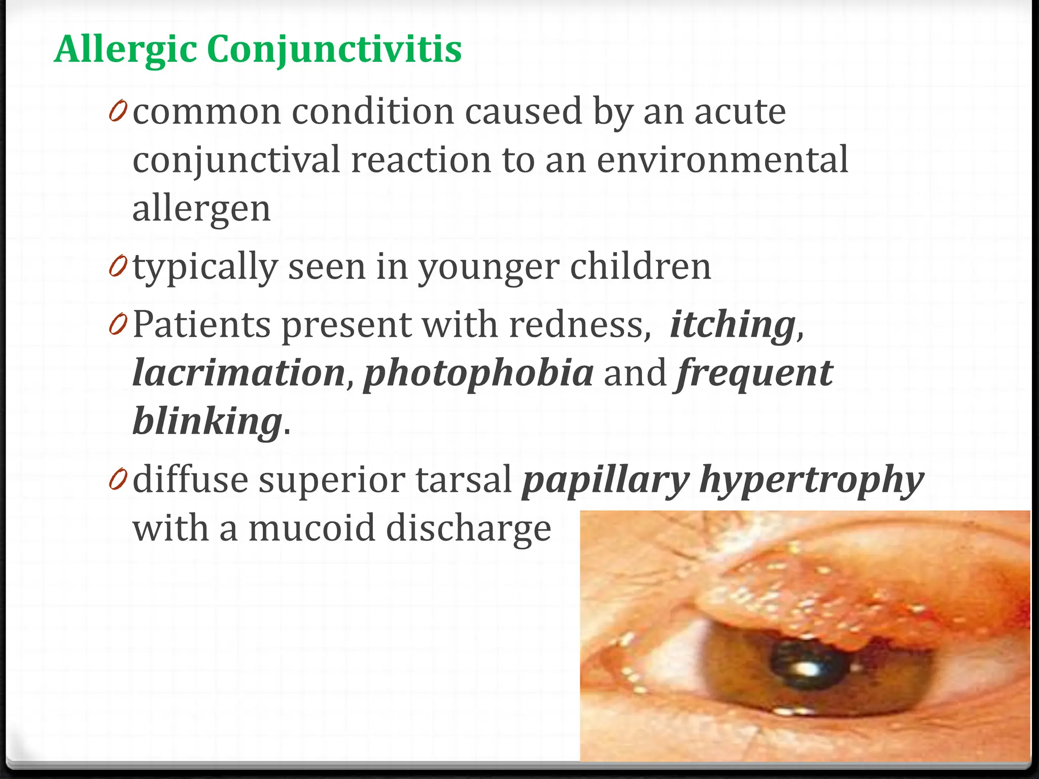 Red eye with Differentials and sample causes | PDF