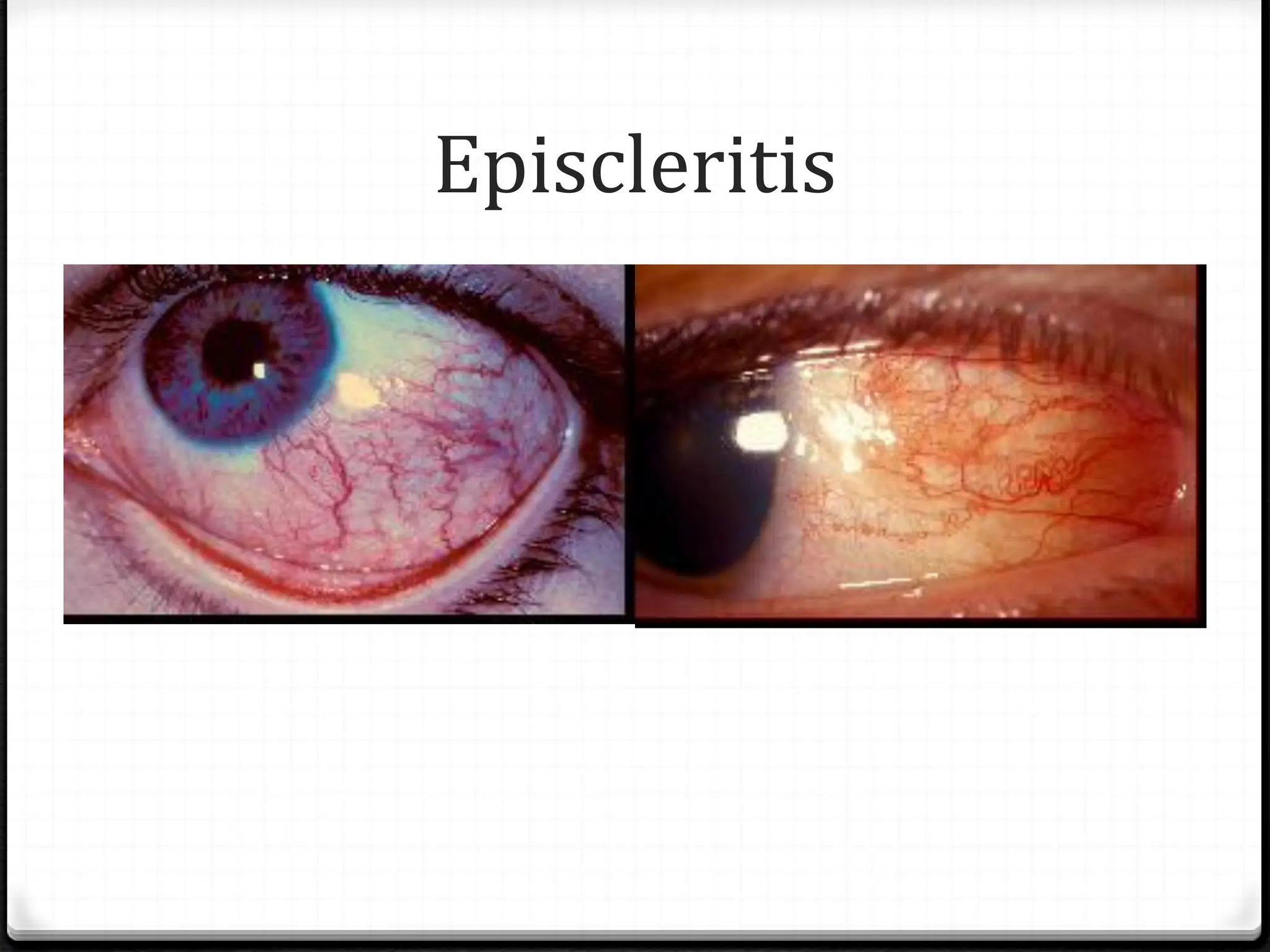 Red eye with Differentials and sample causes | PDF