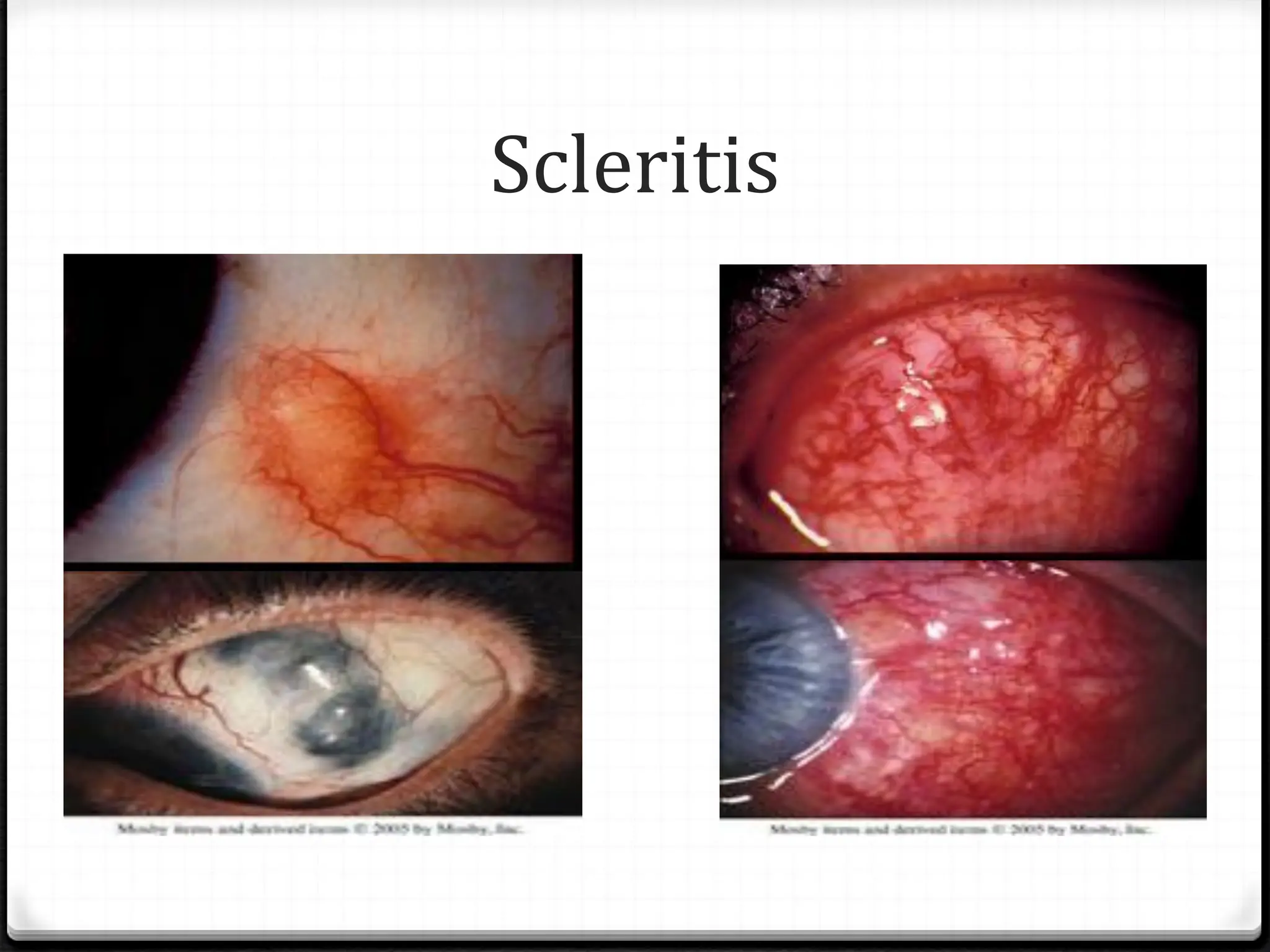 Red eye with Differentials and sample causes | PDF