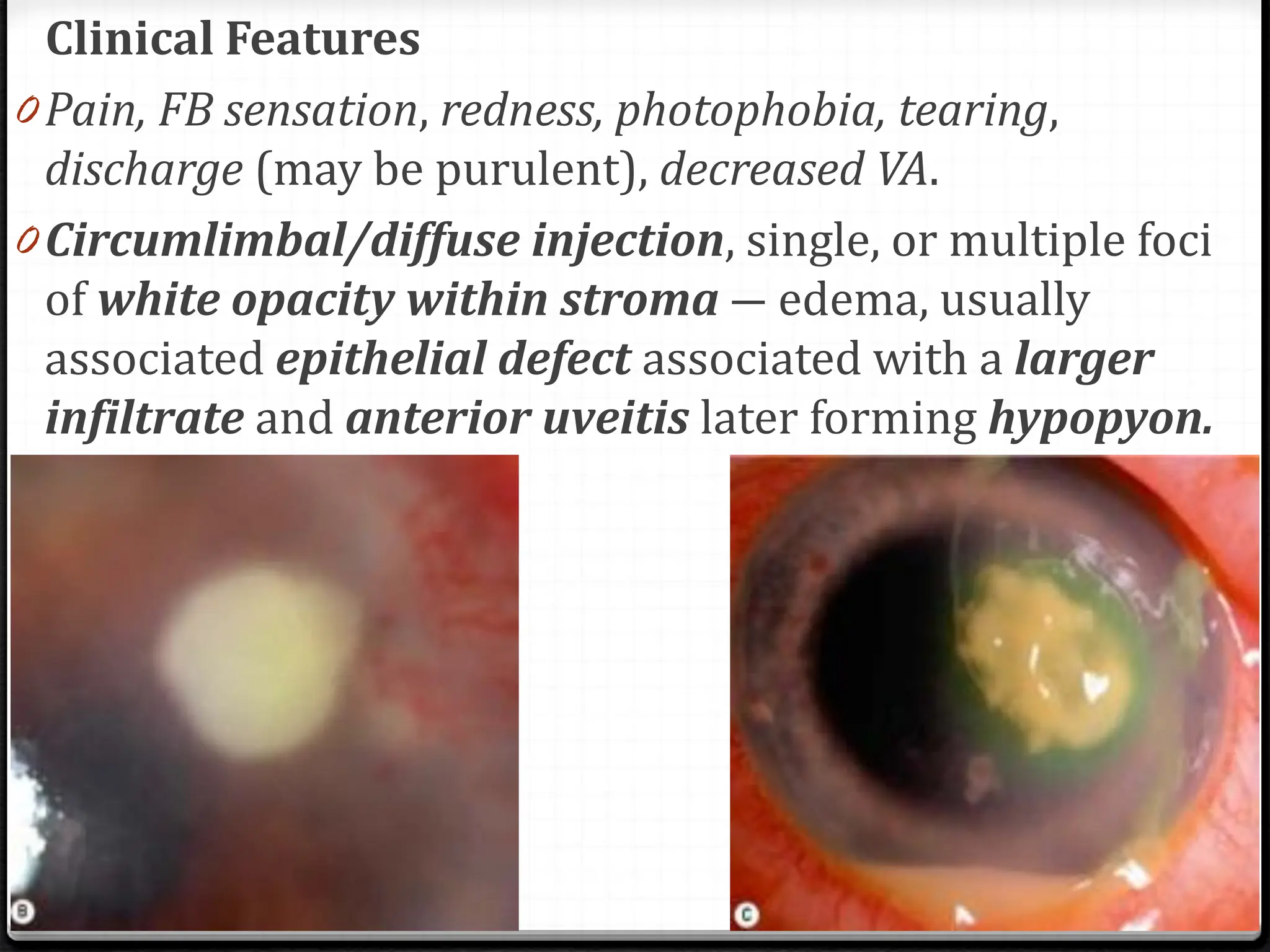 Red eye with Differentials and sample causes | PDF