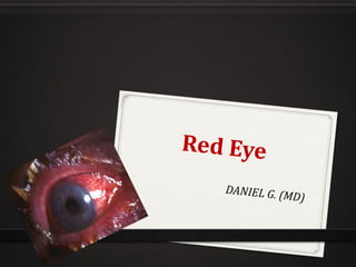 Red eye with Differentials and sample causes | PDF