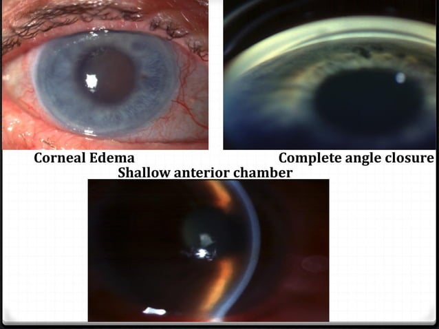 Red eye with Differentials and sample causes | PPT