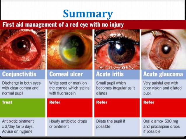 Red eye with Differentials and sample causes | PPT