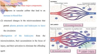 ROLE OF COMPLEMENT SYSTEM IN ACUTE INFLAMMATION.pptx