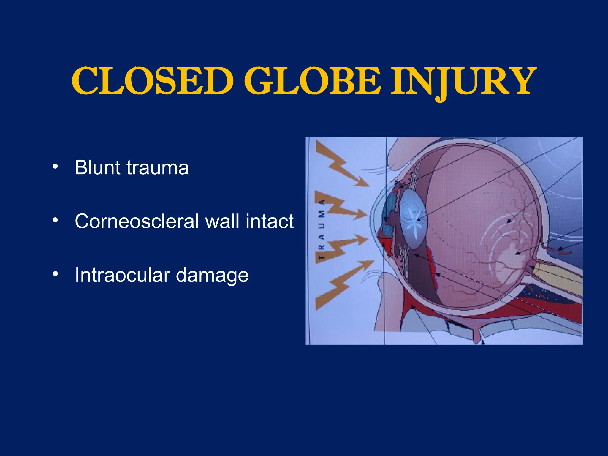 Penetrating Eye Injuries - Introduction, types and Management | PPT | Death, Injury, or Military ...