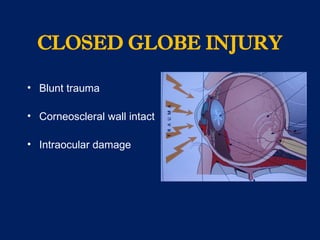 Penetrating Eye Injuries - Introduction, types and Management | PPT