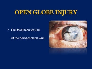 Penetrating Eye Injuries - Introduction, types and Management | PPT