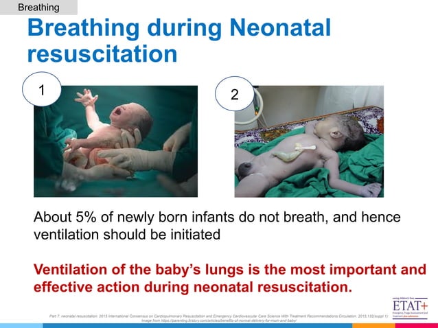 6. Newborn Resuscitation - April 2021.pptx