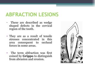 non carious lesion and their managrment tooth structure loss can not be ...