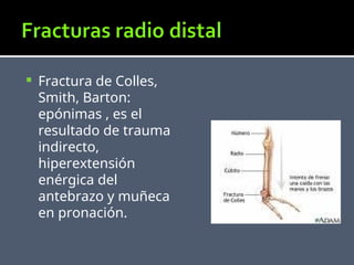 6. Fracturas de radio distal de traumatologia | PPT