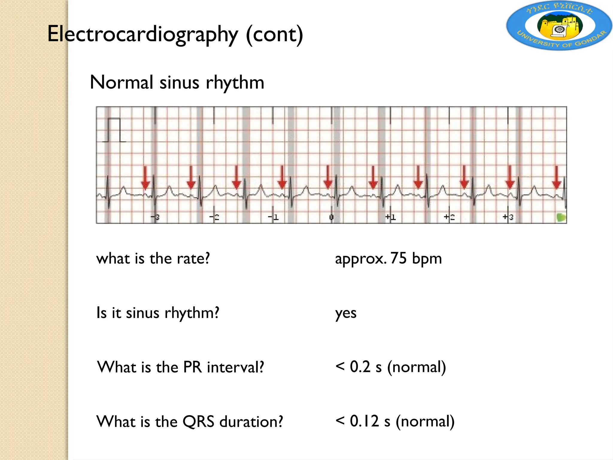 6. Cardiovascular system Monitoring.pptx