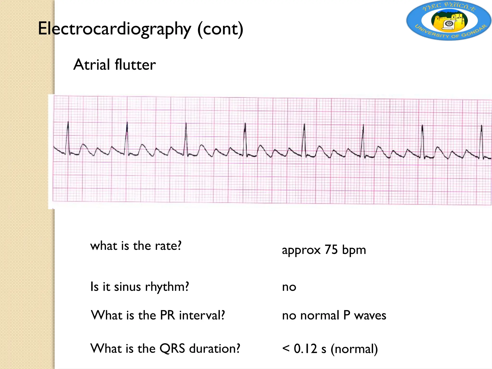 6. Cardiovascular system Monitoring.pptx