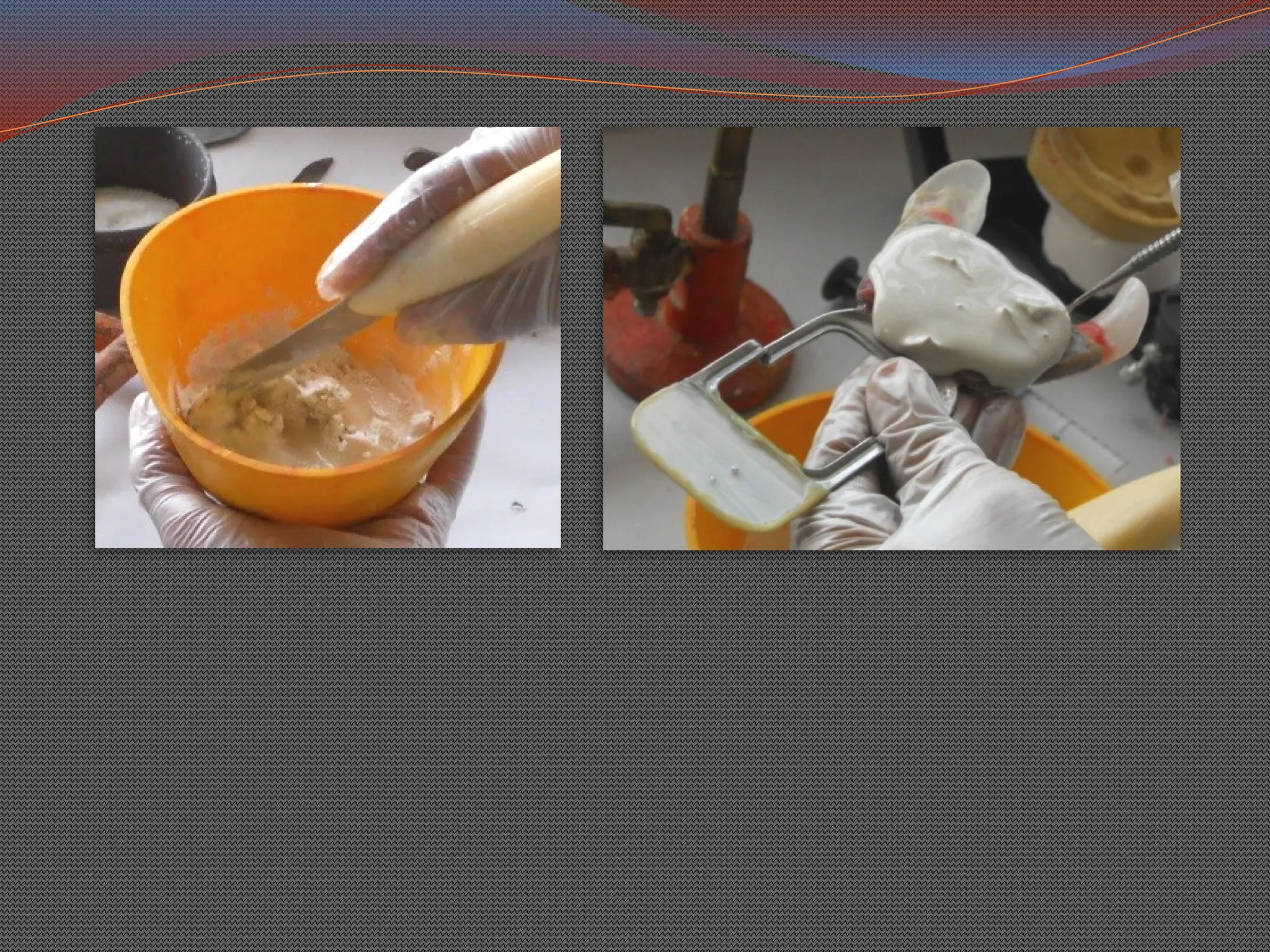 Gothic arch tracing.complete denture denture | PPT