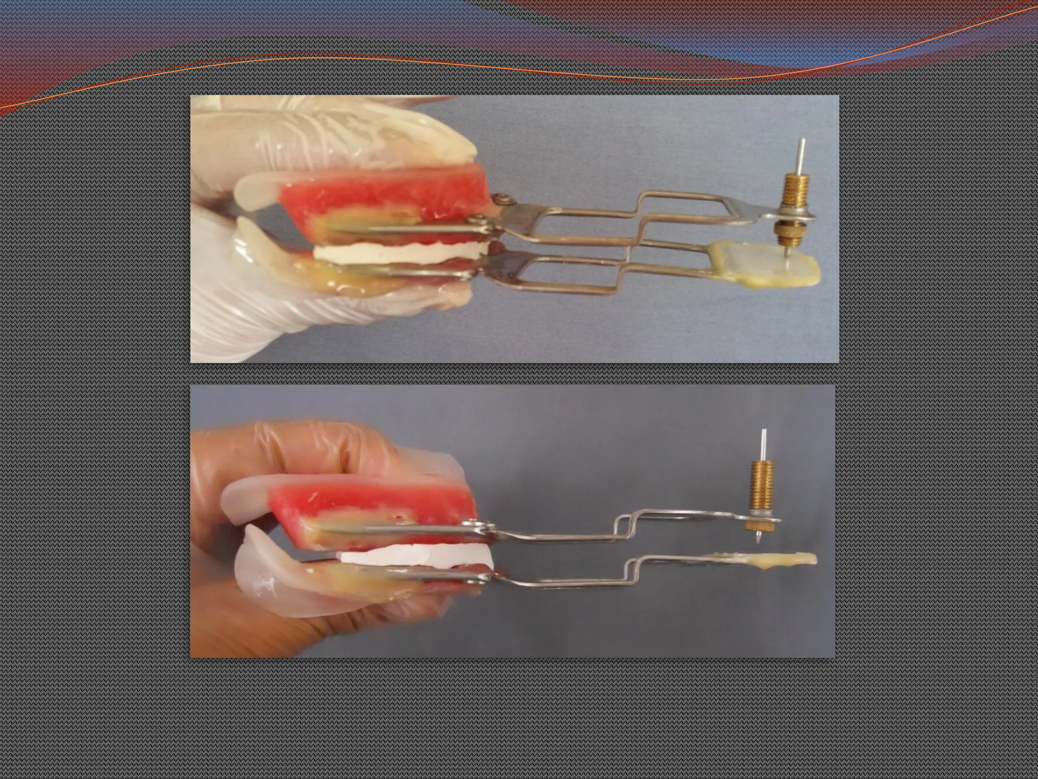 Gothic arch tracing.complete denture denture | PPT