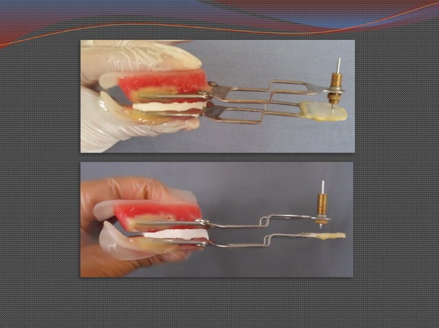 Gothic arch tracing.complete denture denture | PPT